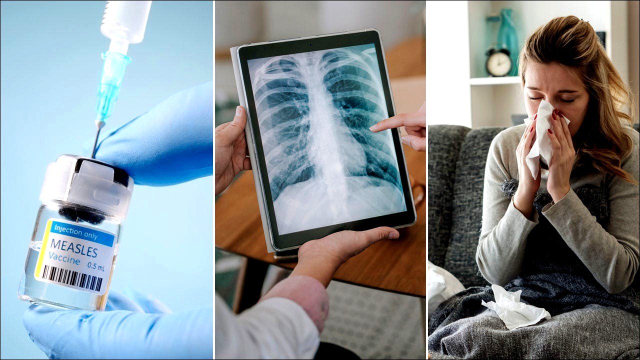 Flu Surge State-by-State, Measles Resurgence, and Worrying Cancer ...